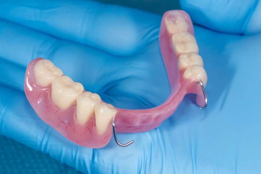 What are fixed and removable dentures for teeth replacement?